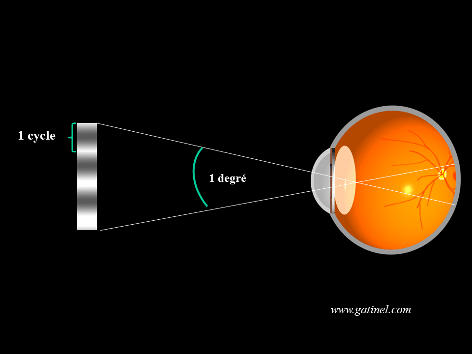Angle visuel - Docteur Damien Gatinel