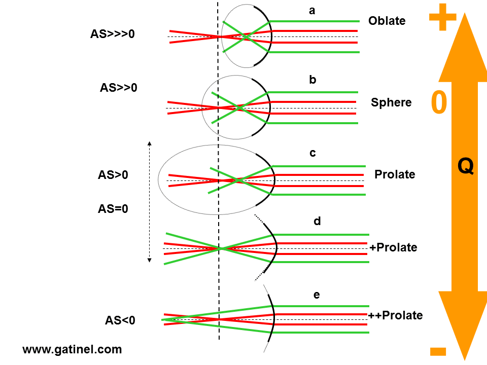 Géométrie de la cornée - Docteur Damien Gatinel