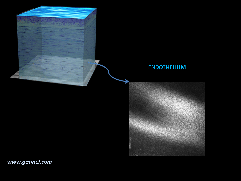 Microscopie confocale - Docteur Damien Gatinel