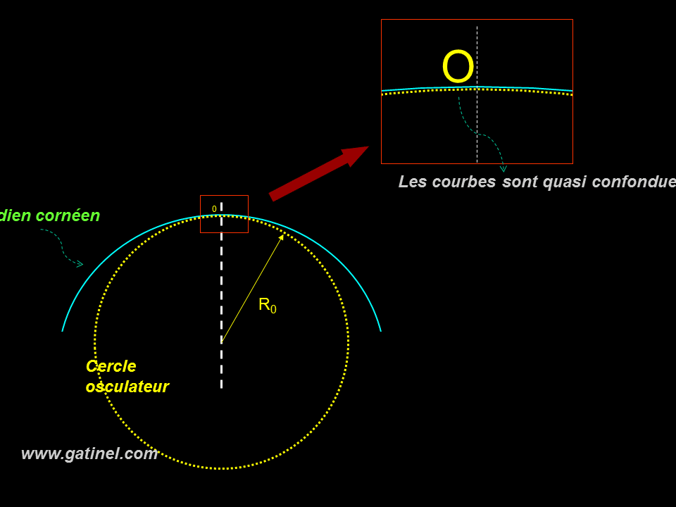 Géométrie de la cornée - Docteur Damien Gatinel