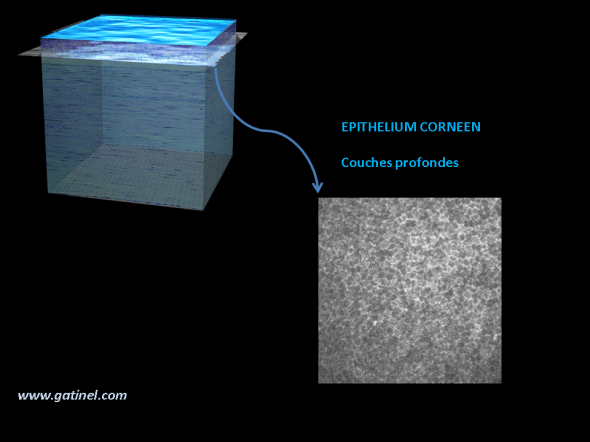 Microscopie confocale - Docteur Damien Gatinel