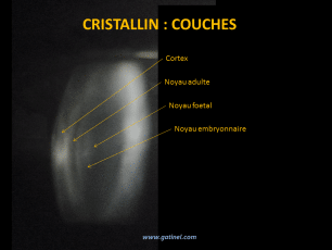 Le cristallin - Docteur Damien Gatinel