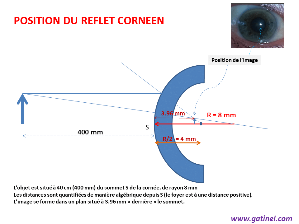 Réflexion sur miroirs courbes sphériques - Docteur Damien Gatinel