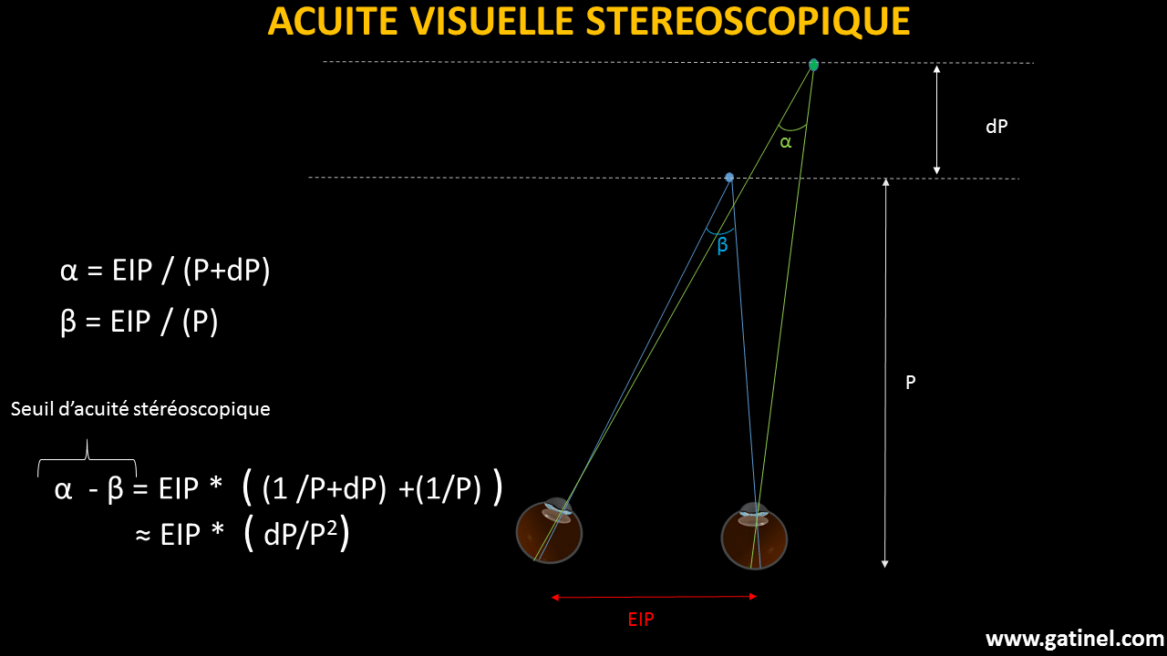Acuité visuelle stéréoscopique - vision du relief - Docteur Damien Gatinel