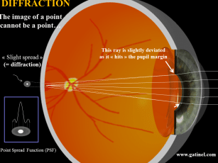 Wavefront sensing - Docteur Damien Gatinel