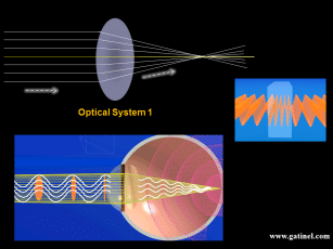 Wavefront sensing - Docteur Damien Gatinel