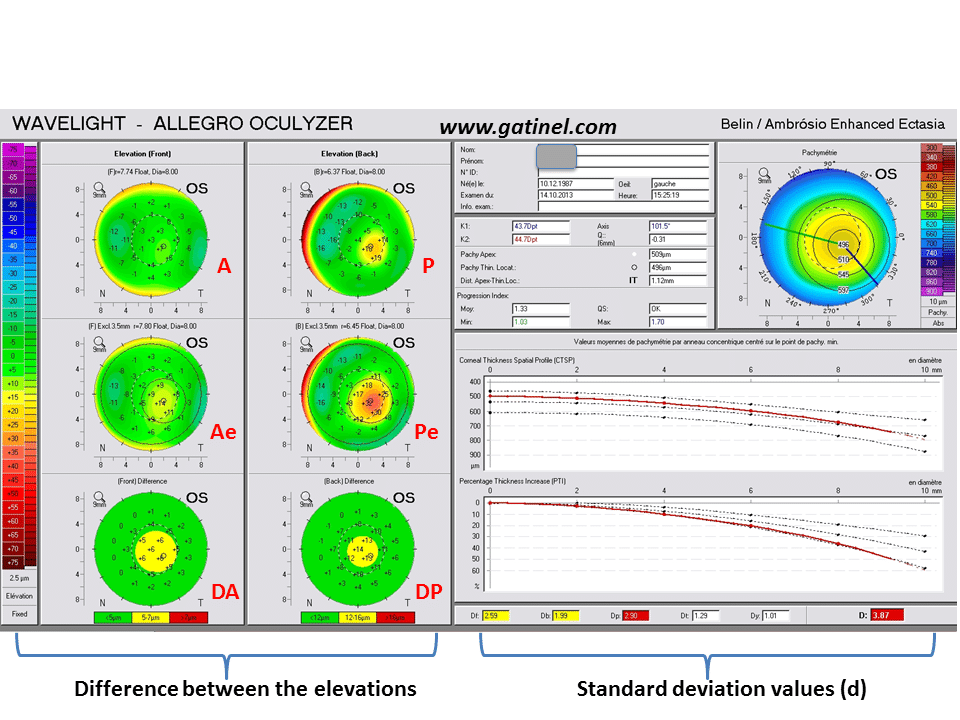 Forme Fruste Keratoconus Topography