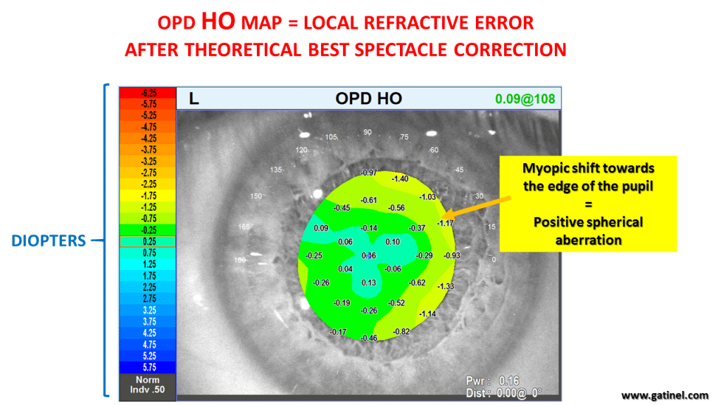 Presbyopia & hyperopia correction using corneal asphericity (Q value ...