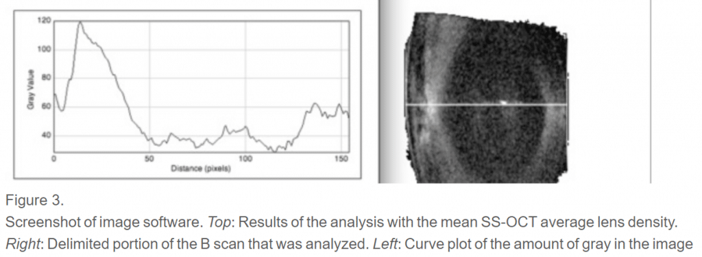 Cataract Grading: Assessment of a New Objective Lens Density ...