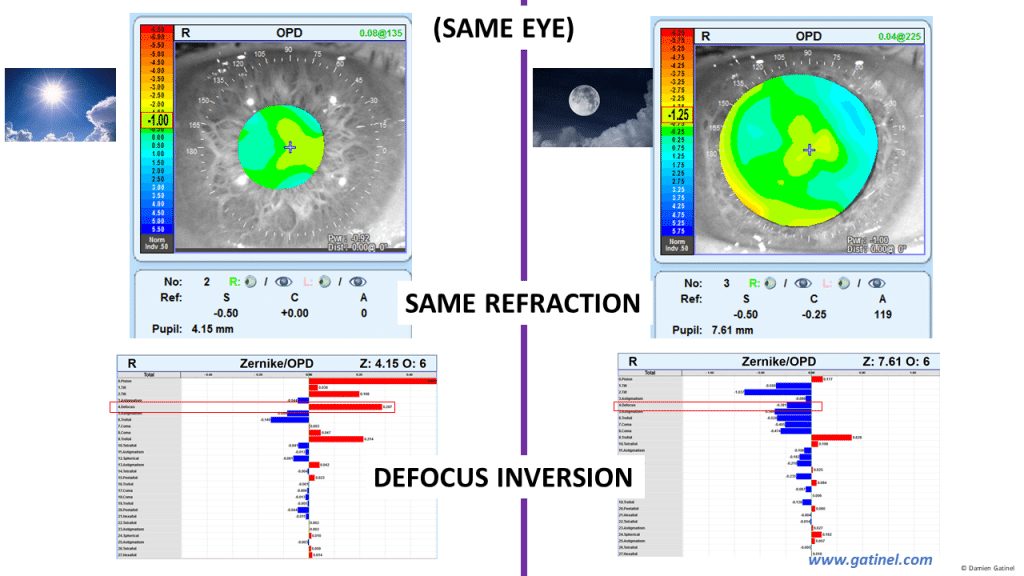 Novel Wavefront Decomposition Method - Docteur Damien Gatinel