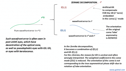 Novel Wavefront Decomposition Method - Docteur Damien Gatinel