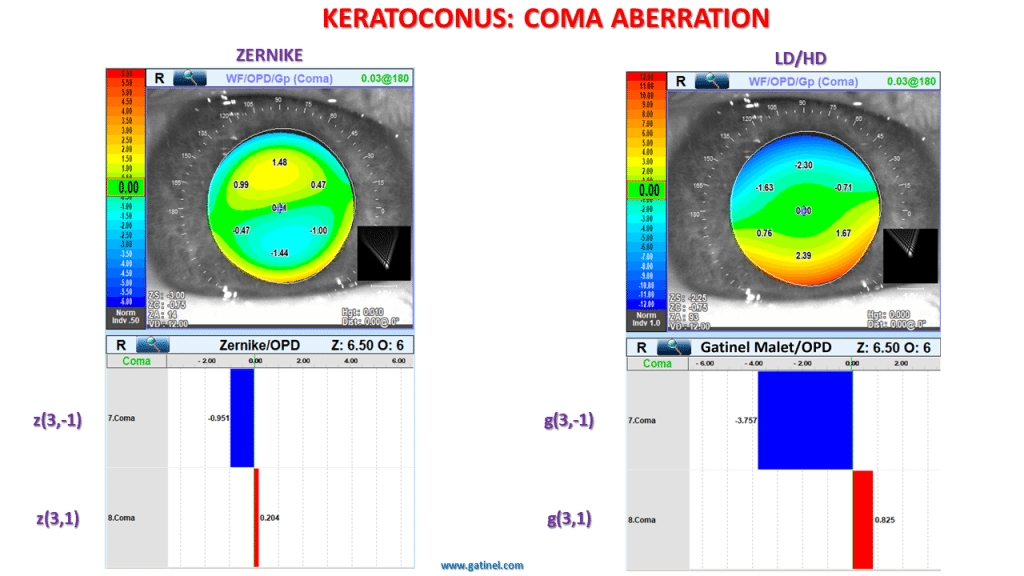 Aberrations in keratoconus - Docteur Damien Gatinel