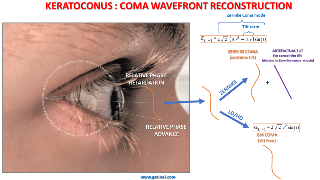 Aberrations in keratoconus - Docteur Damien Gatinel