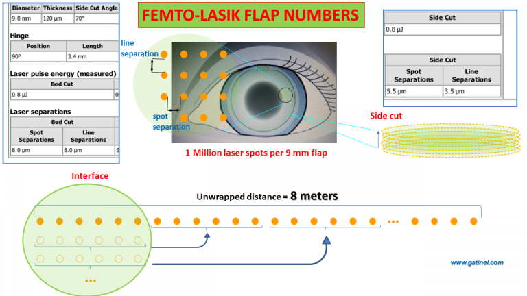 Remarkable numerical facts about Femto-LASIK - Docteur Damien Gatinel