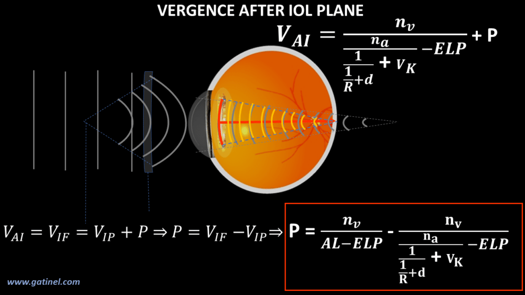 Paraxial optics for IOL power calculation - Docteur Damien Gatinel