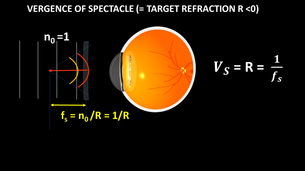 4. Thin lens IOL power computation - Docteur Damien Gatinel