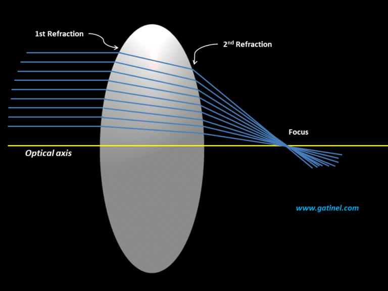 5. Principal planes: explanations - Docteur Damien Gatinel
