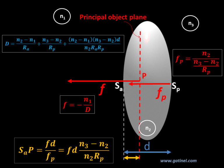 5. Principal planes: explanations - Docteur Damien Gatinel