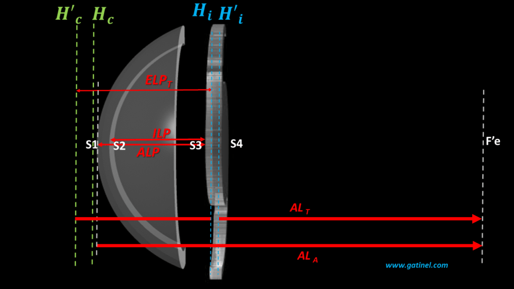 11. Effective Lens Position (ELP) : definition, back-calculation ...
