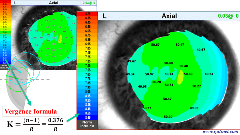 2. From Snell's law to Vergence formula - Docteur Damien Gatinel