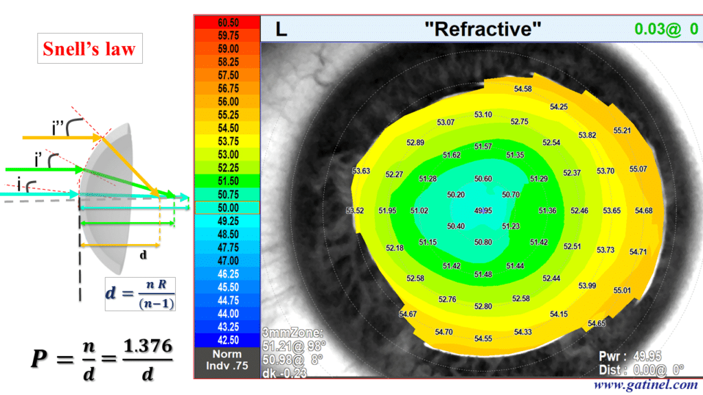 2. From Snell's law to Vergence formula - Docteur Damien Gatinel