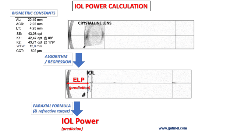11. Effective Lens Position (ELP) : definition, back-calculation ...