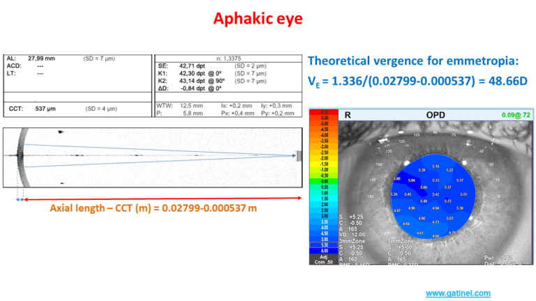 2. From Snell's law to Vergence formula - Docteur Damien Gatinel