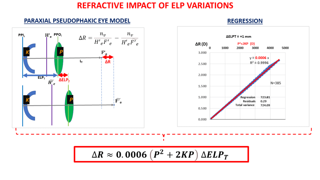 15. Simplified Guide to Optimizing Lens Constant Values of Intraocular ...