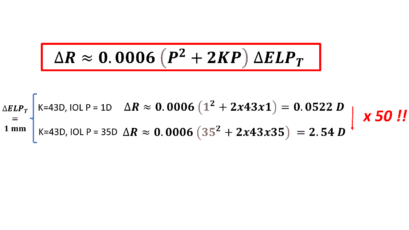 15. Simplified Guide to Optimizing Lens Constant Values of Intraocular ...