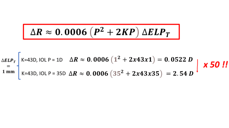 15. Simplified Guide to Optimizing Lens Constant Values of Intraocular ...