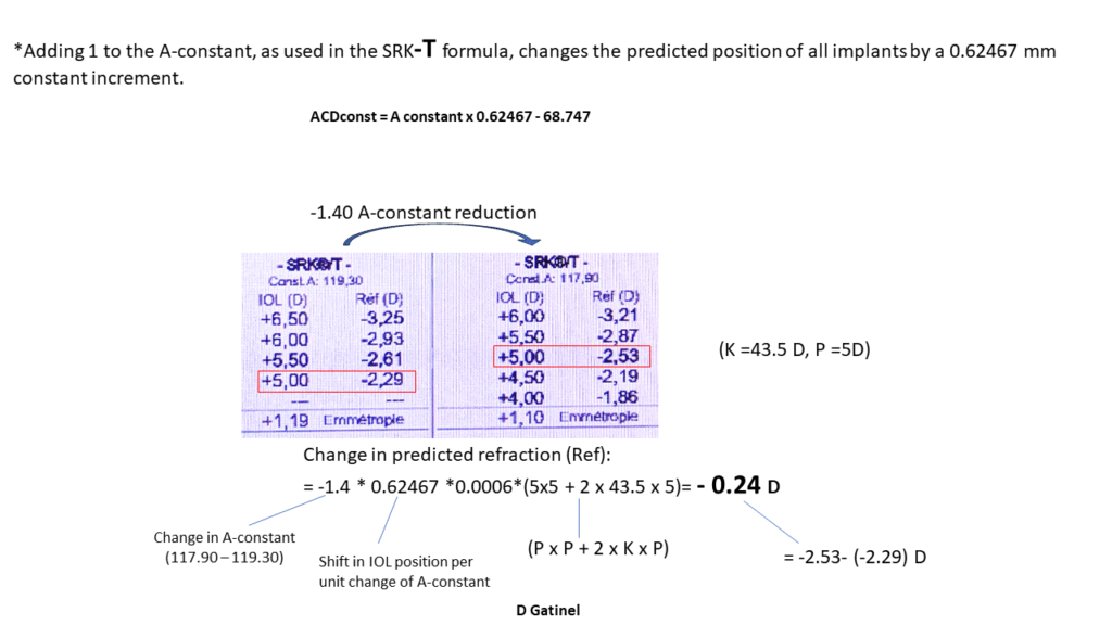 15. Simplified Guide to Optimizing Lens Constant Values of Intraocular Lens Power Formulas for ...