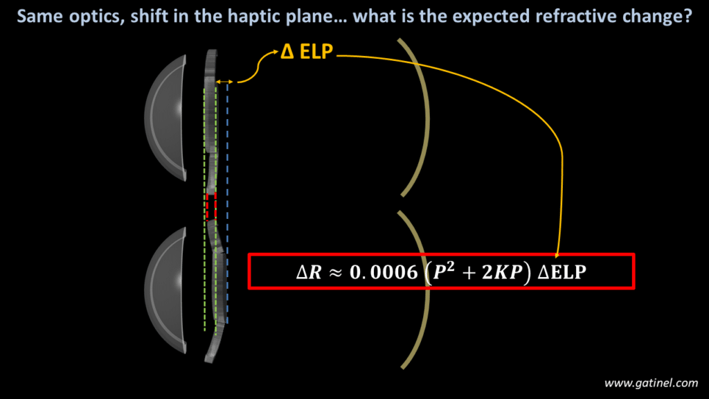 14. Impact of Effective Lens Position on Refraction - Docteur Damien ...