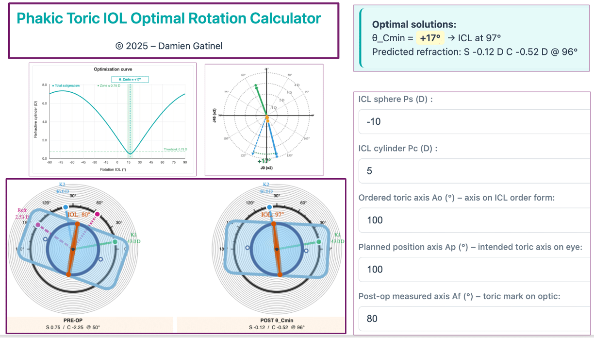 Toric Phakic IOL Optimal Rotation Calculator - Docteur Damien Gatinel